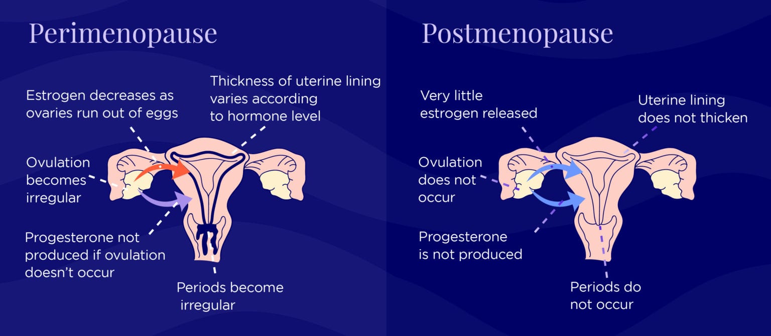 Menopause 101 What You Need To Know Elektra Health