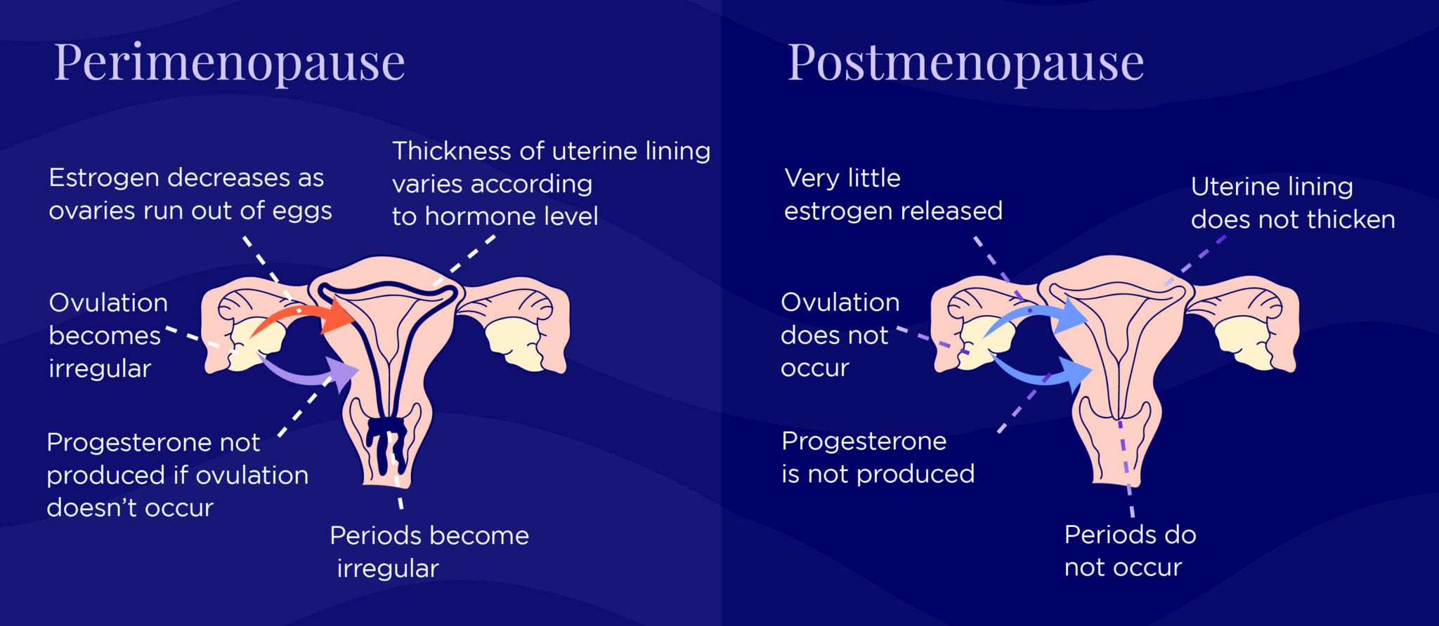Menopause 101: What You Need To Know | Elektra Health